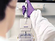 BSE test wins accolade for Swiss company - SWI swissinfo.ch