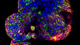 EPFL scientists advance method to make lab-grown livers - SWI swissinfo.ch