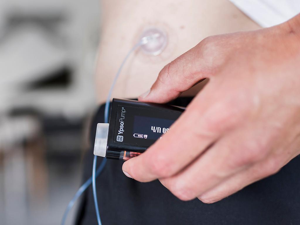 Ypsomed en quête d'un remplaçant pour distribuer l'Ypsopump aux USA ...