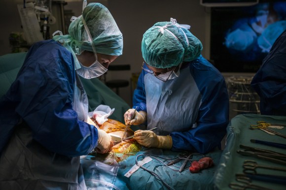 Switzerland's organ shortage leads to record mortality in 2022 - SWI ...